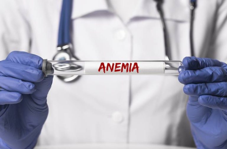 Anemia - Simptomat, Llojet, Shkaqet dhe Trajtimi - Spitali CONTINENTAL
