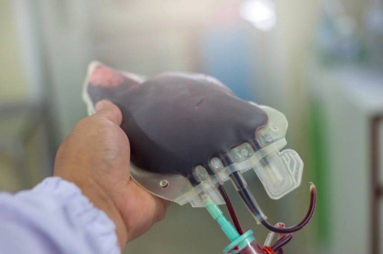 Anemia - Simptomat, Llojet, Shkaqet dhe Trajtimi - Spitali CONTINENTAL