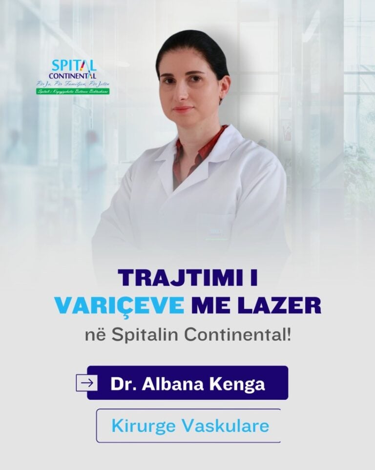 Varicet (Venat Varikoze) | Trajtimi me lazer në Spitalin CONTINENTAL